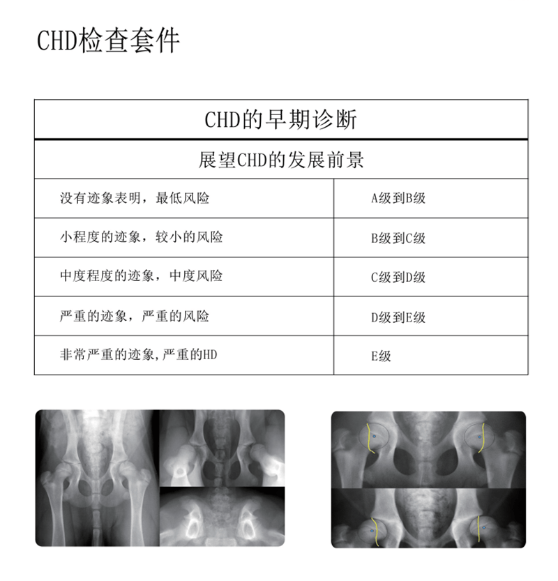 CHD检查套件 - BlueSAO®佰陆
